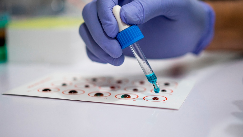 Vdrl Cuantitativo Lapi Laboratorio Médico 